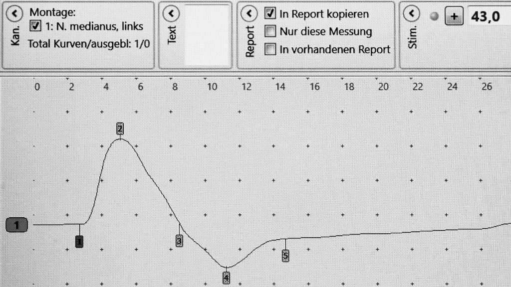 Klinische Elektrophysiologie – Neurologische Praxis am Rathausmarkt